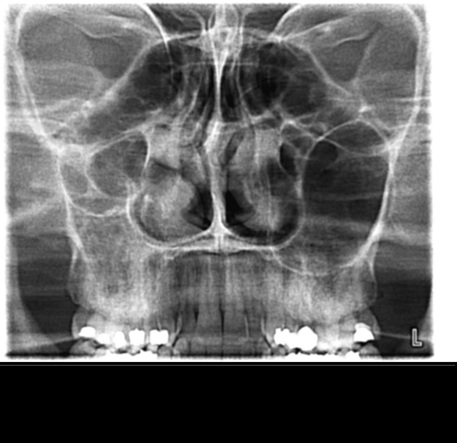 Pro lékaře | zubnirentgenbrno.cz